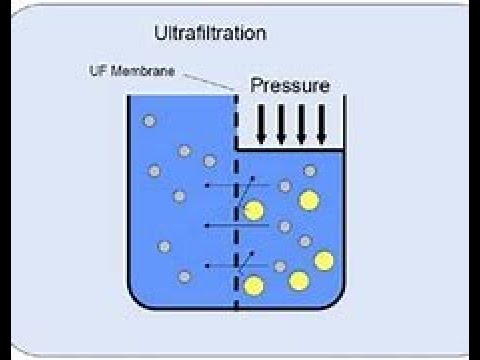 10 28 22 Ultrafiltration in hemodialysis patients - YouTube