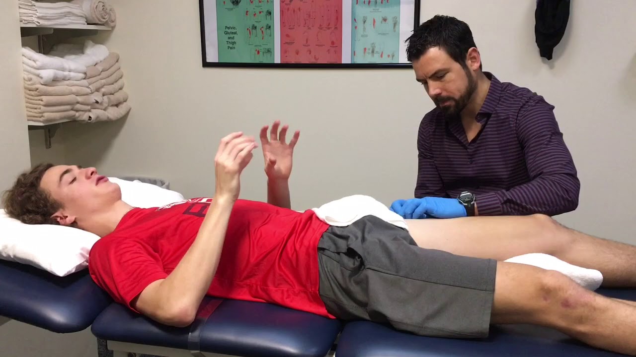 Dry needling ITB - YouTube