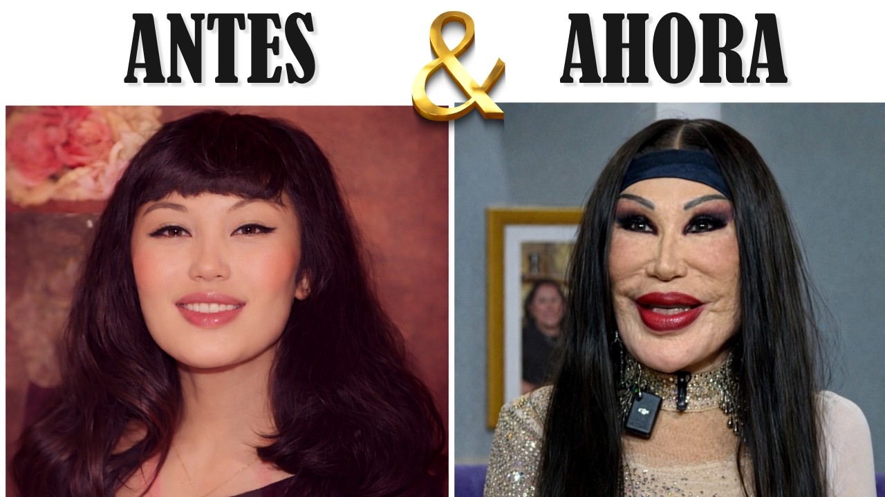 10 Famosos Latinos Que Cambiaron Drásticamente Tras la Cirugía - YouTube