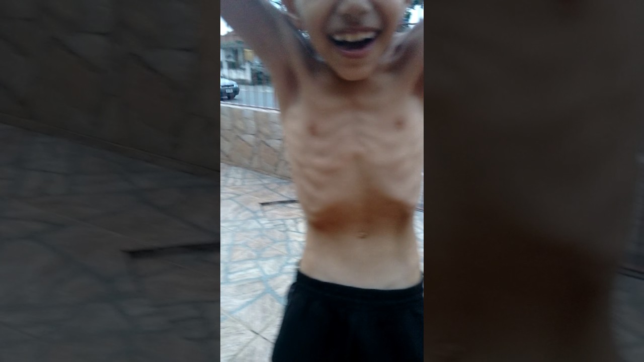 Homem Mais Magro Do Mundo