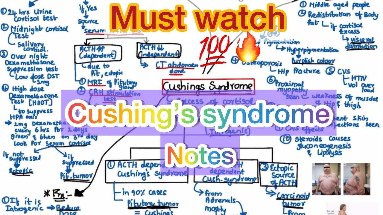 Cushing’s syndrome (causes,features,diagnosis,treatment) - YouTube