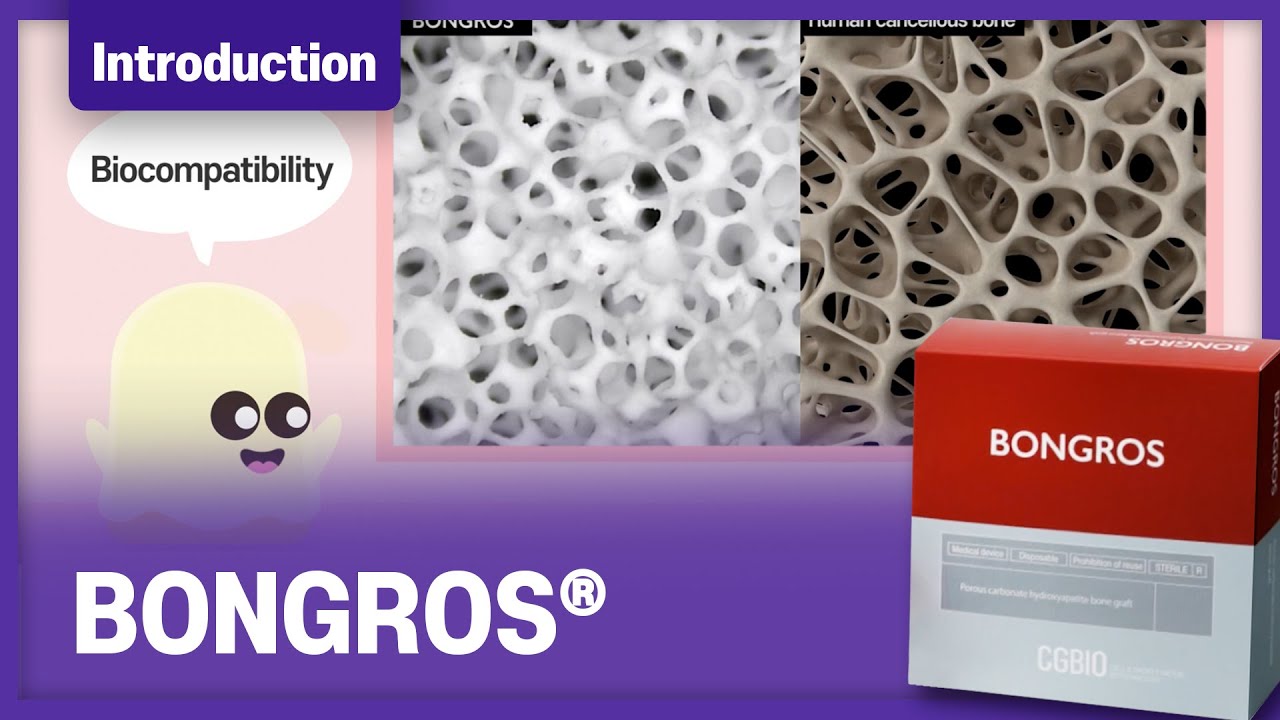 [BONE/SPINAL] 본그로스(BONGROS)에 대해 - YouTube