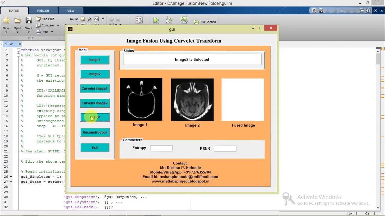 Image Fusion Using Curvelet Transform Matlab Project - YouTube
