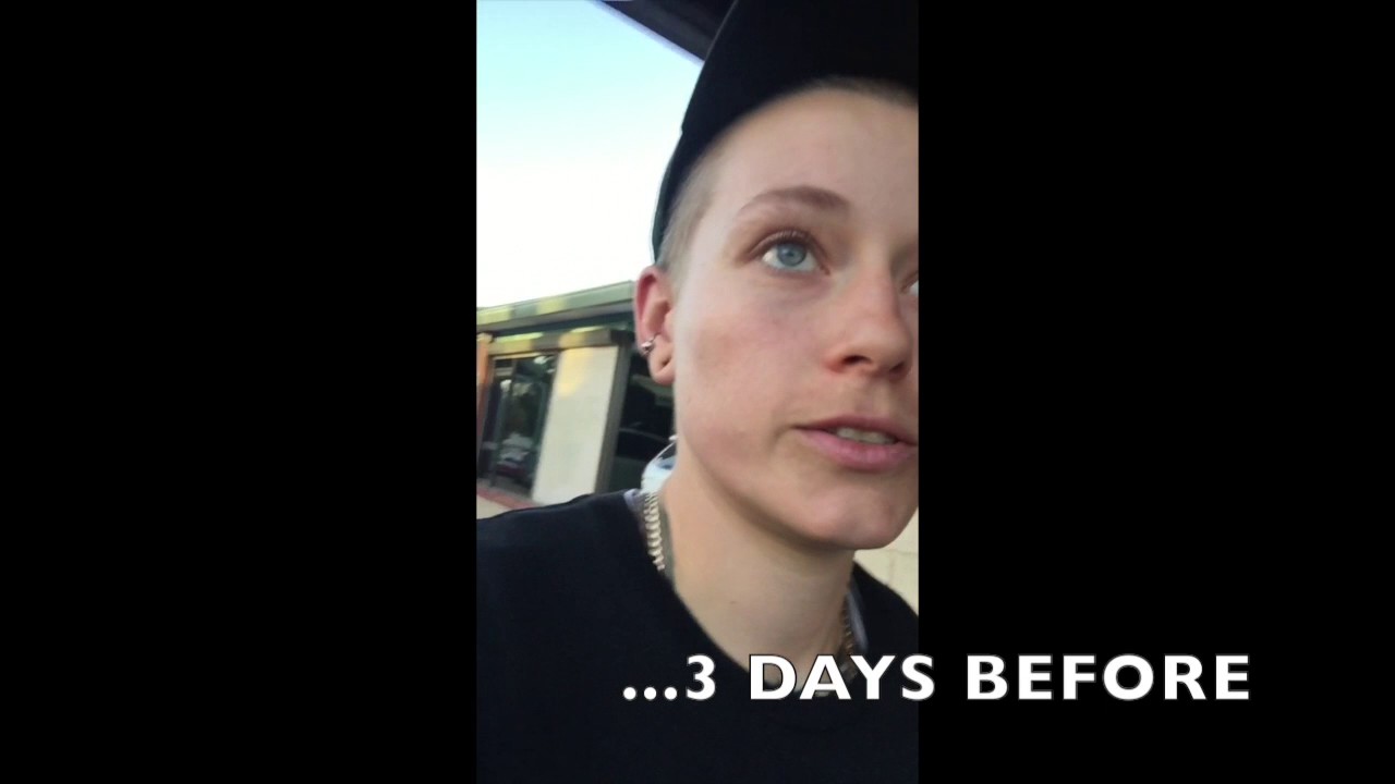 FtM Life- Starting testosterone - YouTube