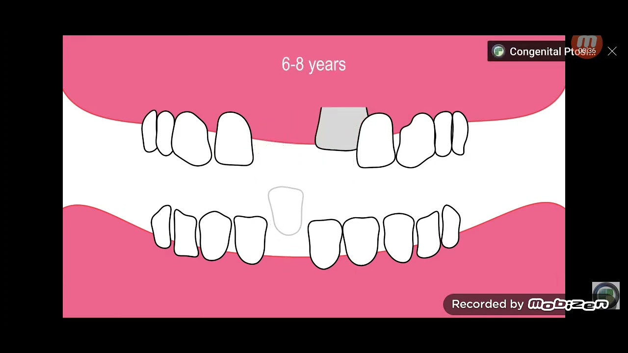 Baby Teeth to Adult Teeth Time Lapse Animation - YouTube