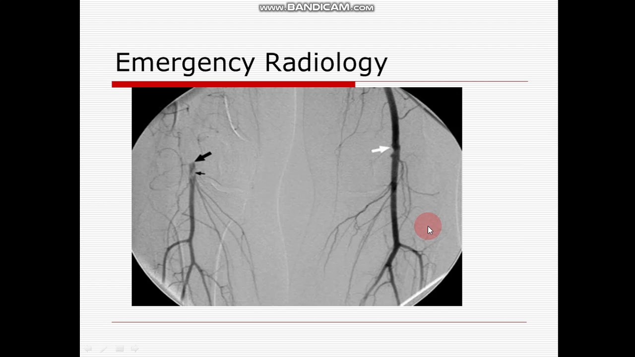 Radiographics Emergency Radiology at Caitlyn Tooth blog