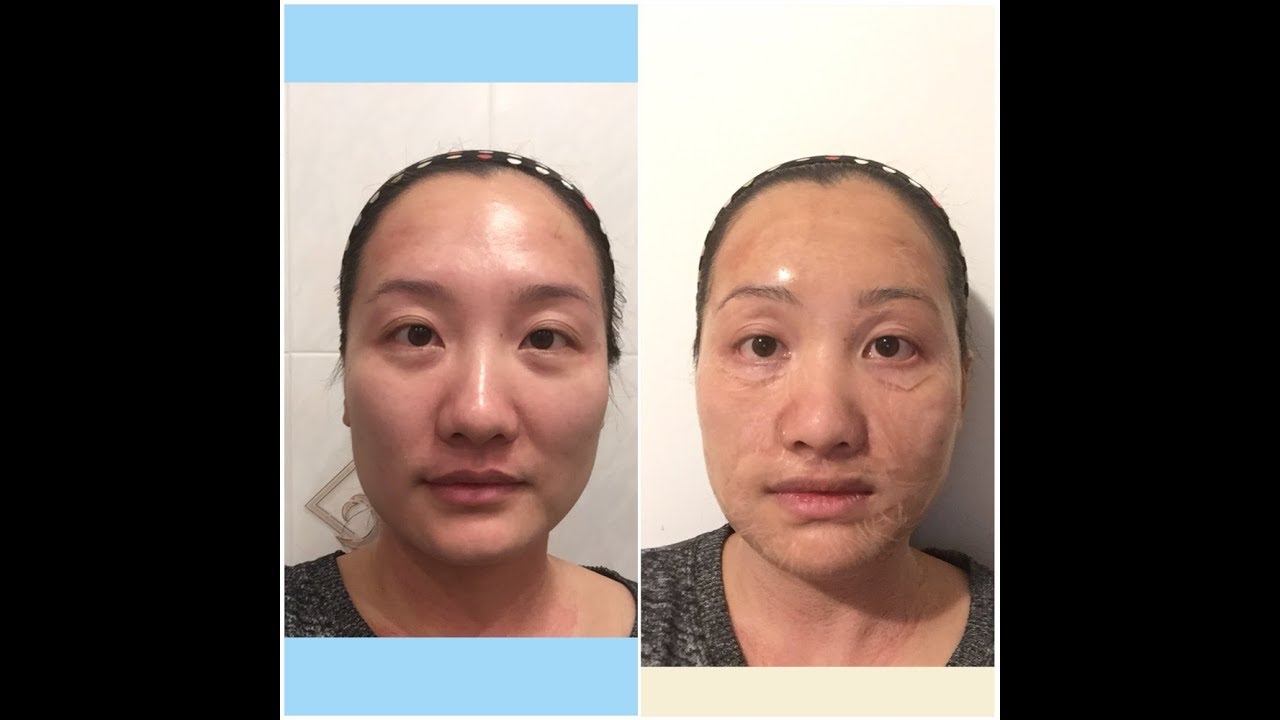 Complete Hanacure Korean Facial Mask Review - YouTube