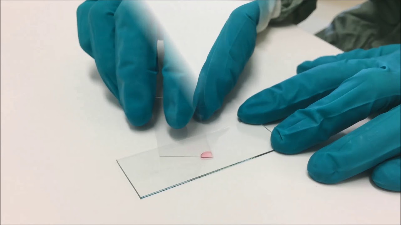 FertiPro_LeucoScreen Plus - YouTube