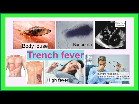 trench fever - YouTube