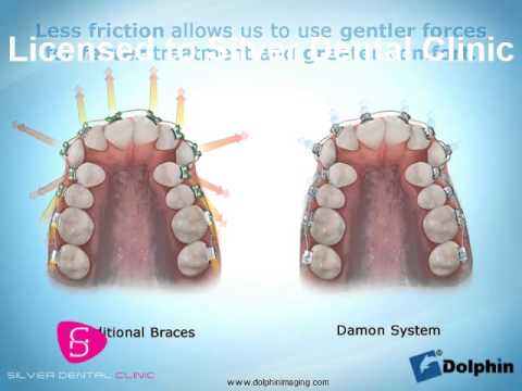 Damon System - YouTube