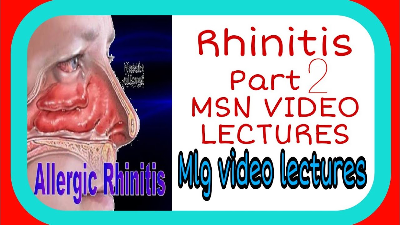 RHINITIS MANAGEMENT ||MSN VIDEO LECTURES || MLG VIDEO LECTURES - YouTube