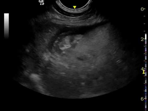 What Happens When Dogs Gallbladder Ruptures