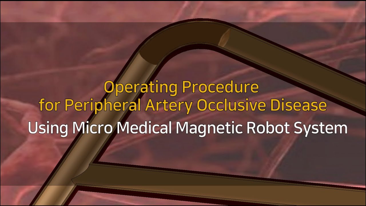 Operating Procedure for Peripheral Artery Occlusive Disease using ...