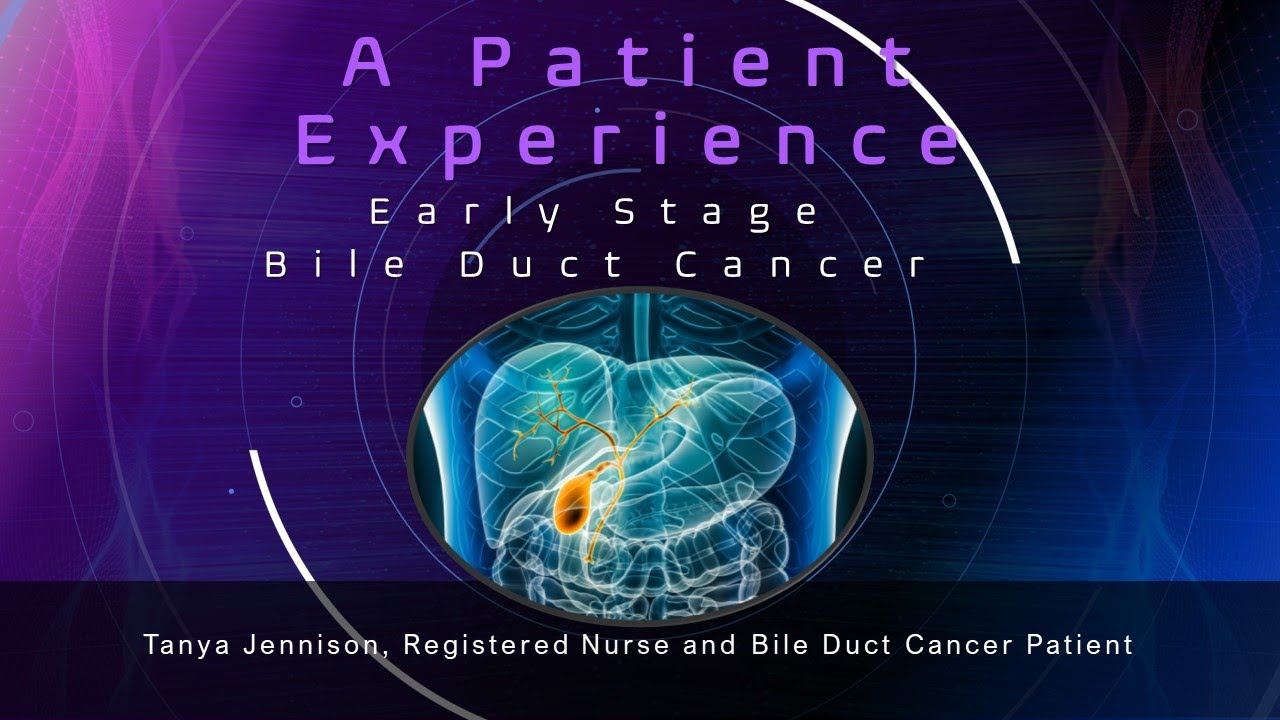 What is Early Stage Bile Duct Cancer? - YouTube