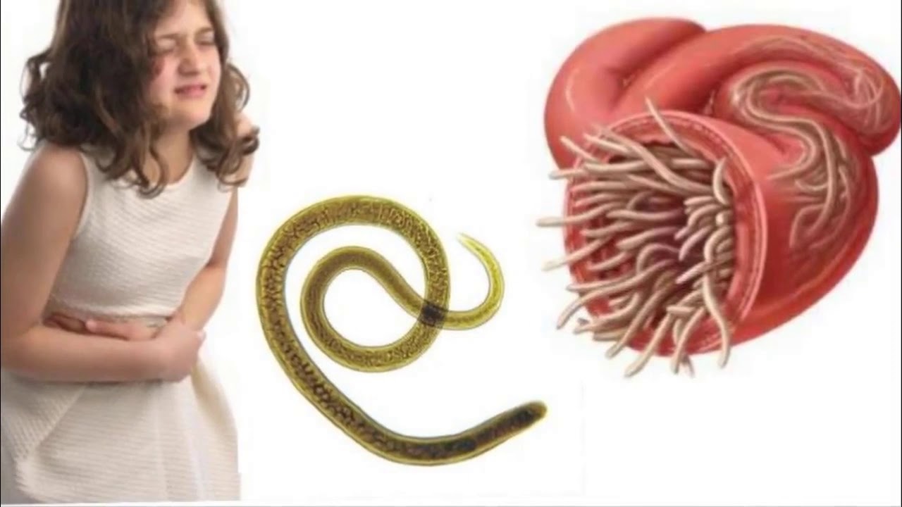 Farmaci contro parassiti intestinali. - YouTube