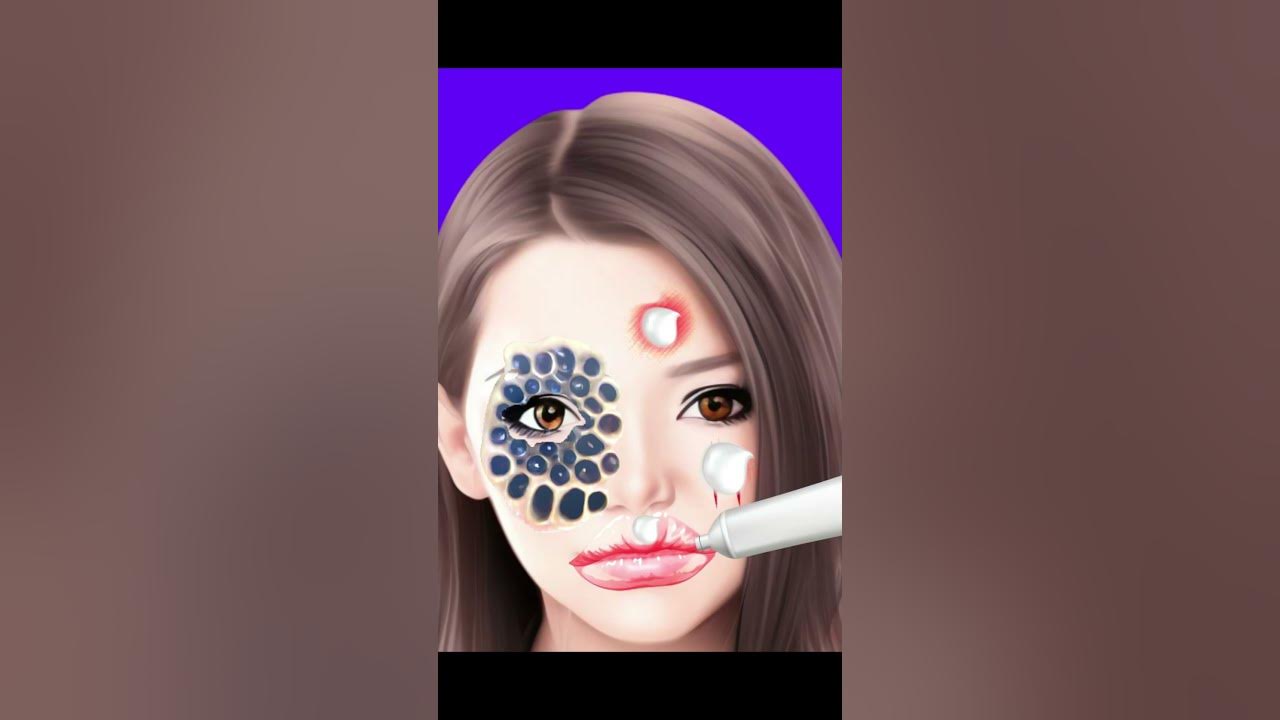 Asmr 여드름 피부 관리 애니메이션 Face Stone Removal Skin Care Spa Facial Makeup Facetreatment Asmr Youtube