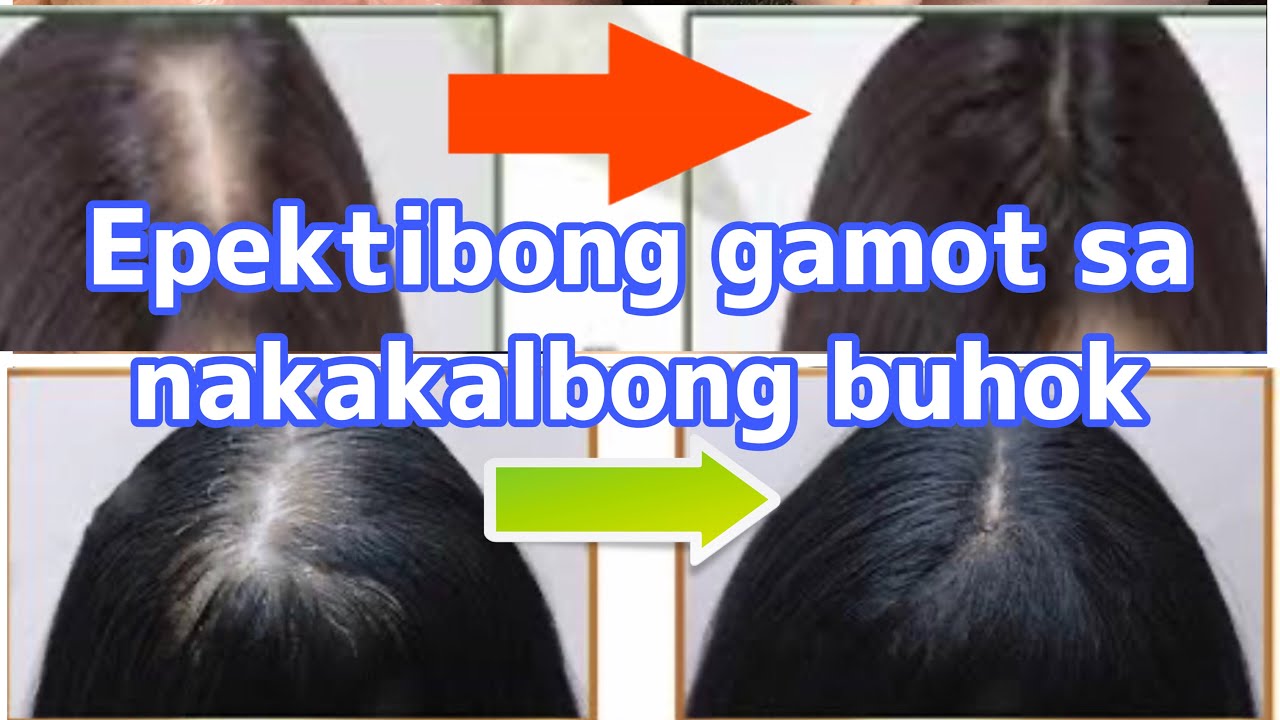 EFFECTIVE HAIR GROWTH/PAMPAKAPAL NG BUHOK AT MABILIS HAHABA ANG BUHOK ...