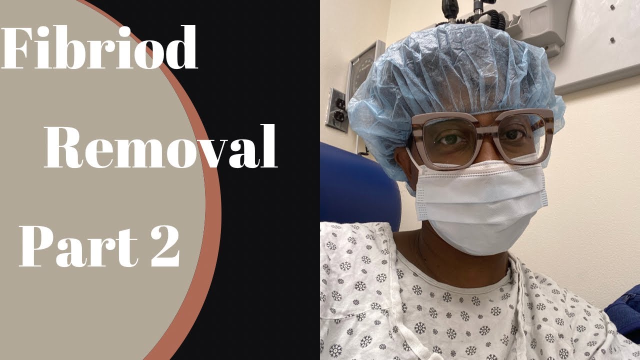 Fibroid Removal Part 2 (Myomectomy) - YouTube