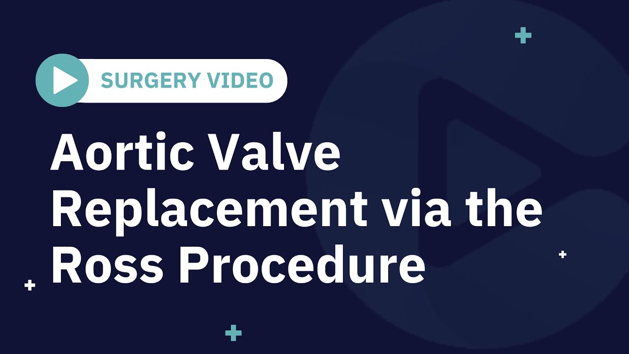Surgery Video: Aortic Valve Replacement via the Ross Procedure - YouTube