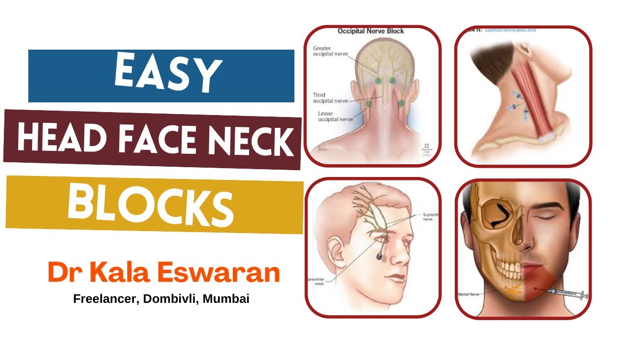 Mastering Head, Face, and Neck Blocks: Essential Techniques for ...