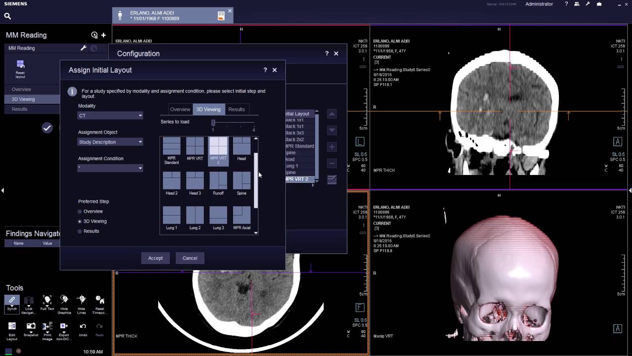 syngo.via Setting Display Layout Preferences - YouTube