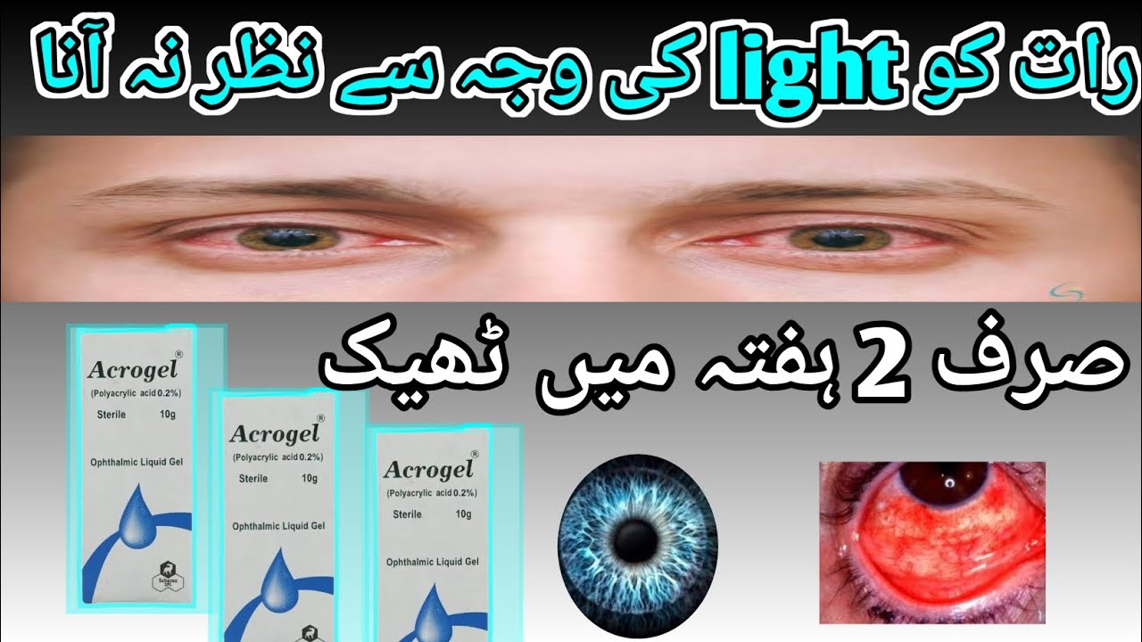 acrogel eye drops || acrogel eye gel #medicine - YouTube