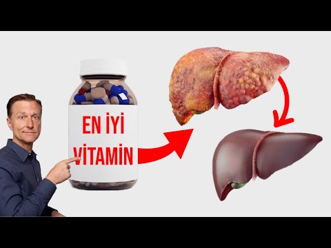 Karaciğer Yağlanmasının Giderilmesi İçin En İyi Vitamin | Dr.Berg Türkçe