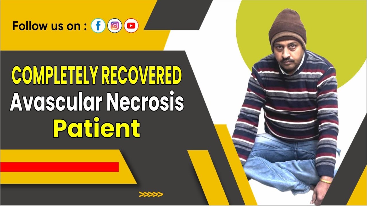 Completely recovered Avascular Necrosis Patient | No Problem | Normal ...