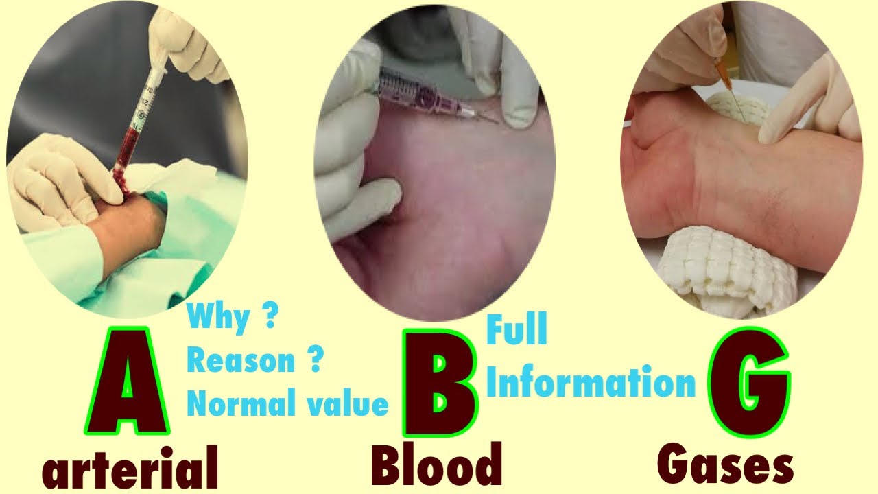 What is ABGs ? | ABGs | full details about ABGs why we can perform ABG ...