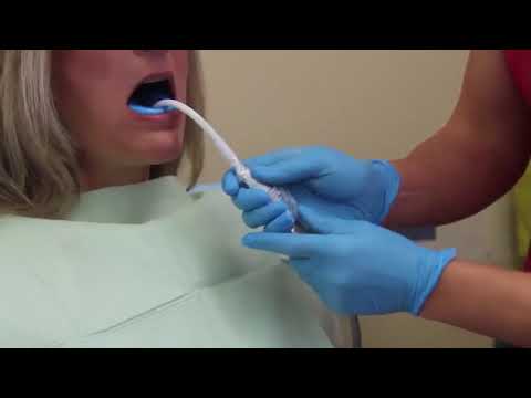 Septodont Fluocal Fluoride Gel - How to Use - DENTBEAR - YouTube