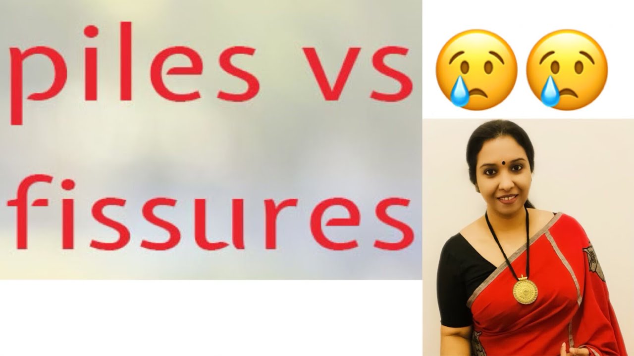 Piles vs Fissures // Understanding the difference - YouTube