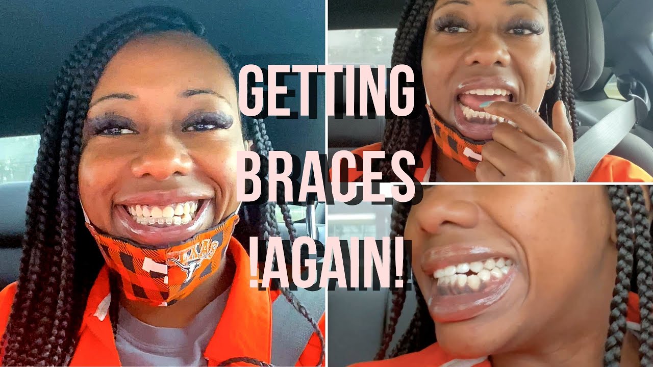 GETTING BRACES...AGAIN! | Adult Braces - YouTube