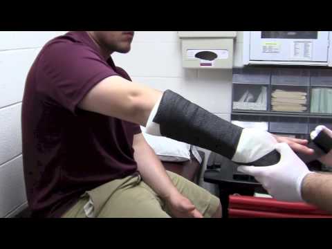 Ulnar Gutter Splint - YouTube