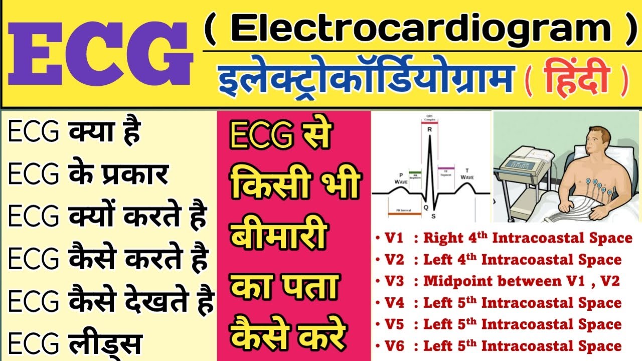 ECG Electrocardiogram ECG Test ECG Procedure ECG Report ECG