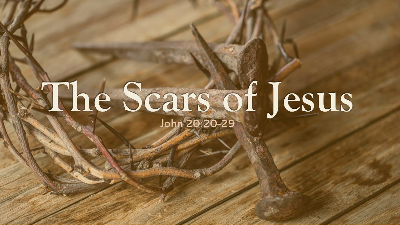 The Scars of Jesus - YouTube