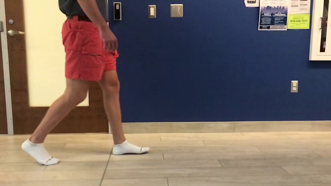 Excess Eversion - Lateral View - YouTube