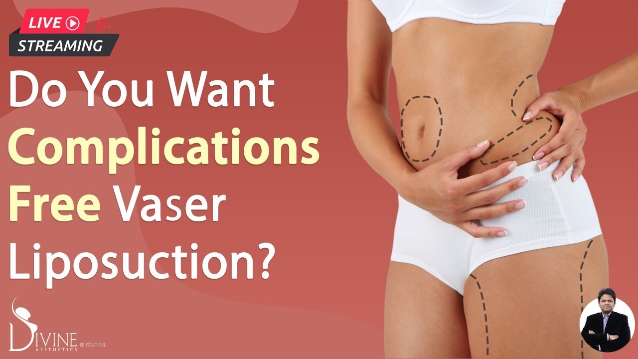 Do you want Complications Free Vaser Liposuction? - YouTube
