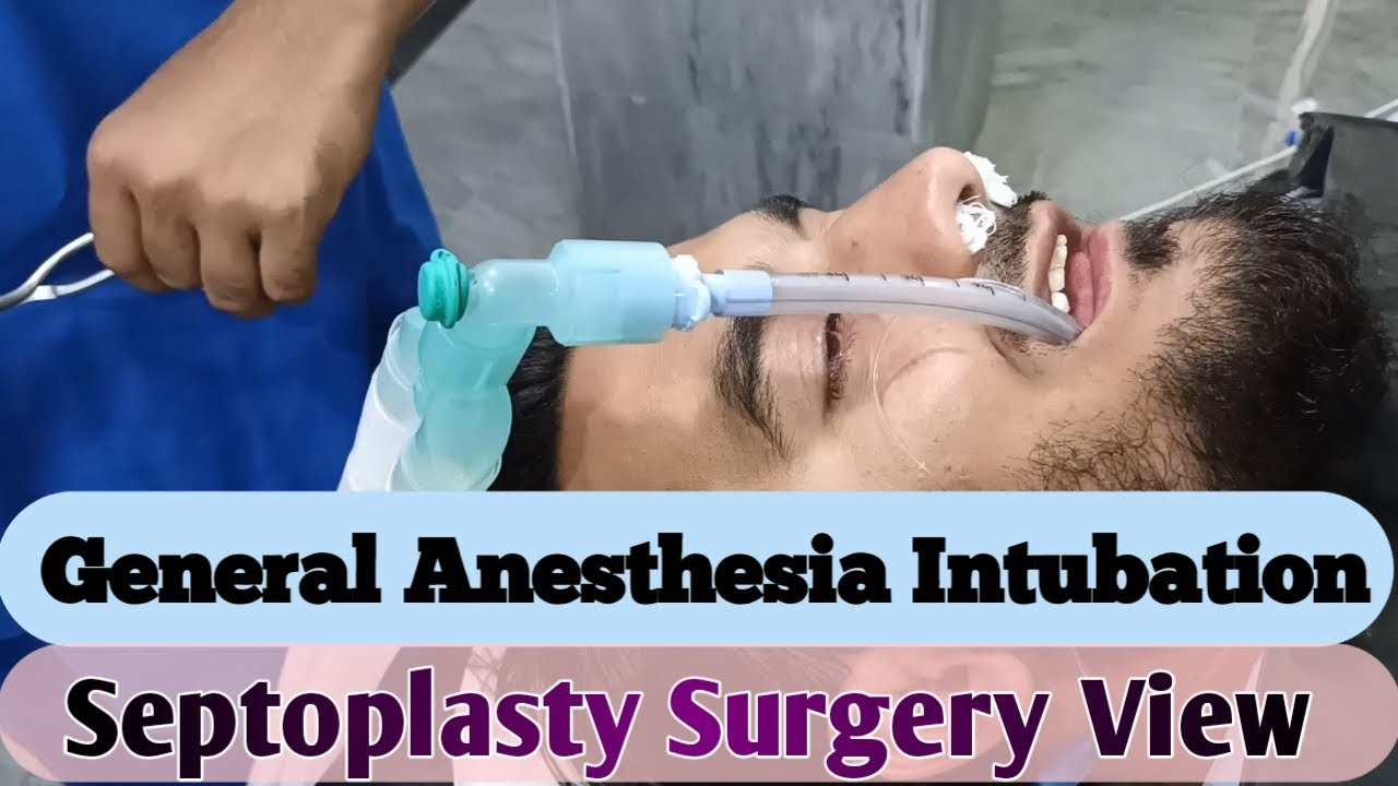 General Anesthesia Intubation Procedure | Septoplasty Surgery View ...