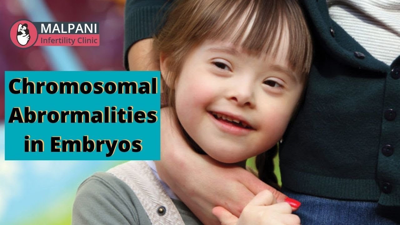 Complete guidance on the chromosomal disorder or chromosomal ...