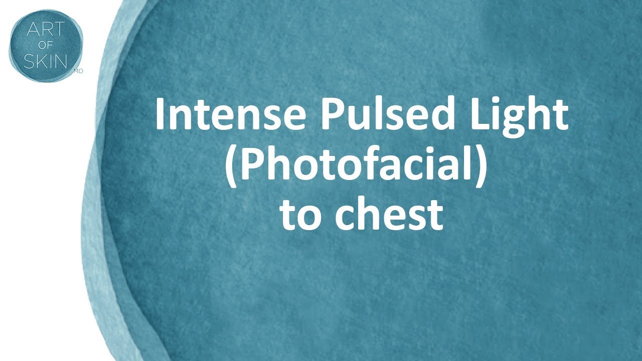Chest Rejuvenation of décolleté with IPL Photodynamic Therapy - YouTube