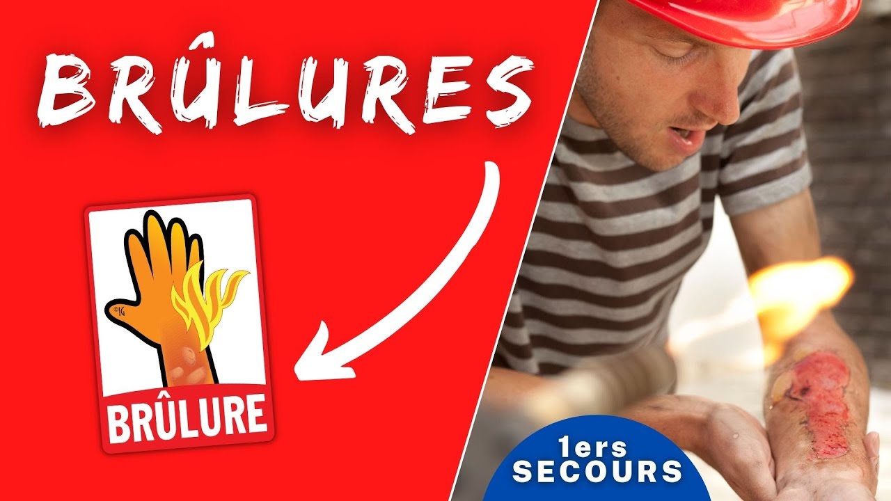 Les brûlures : comment réagir face à une BRÛLURE ? ı Formation premiers ...