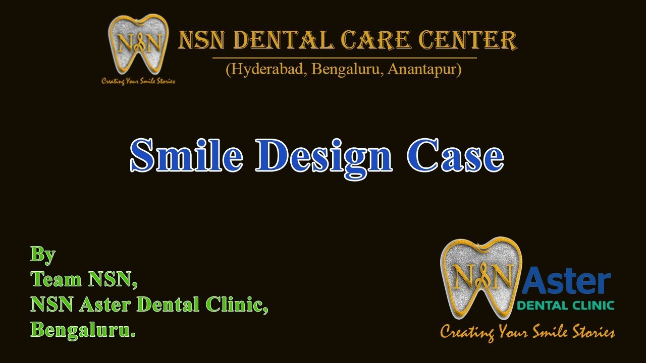 Smile Design Case | NSN Aster Dental Clinic | NSN Dental Care Center ...