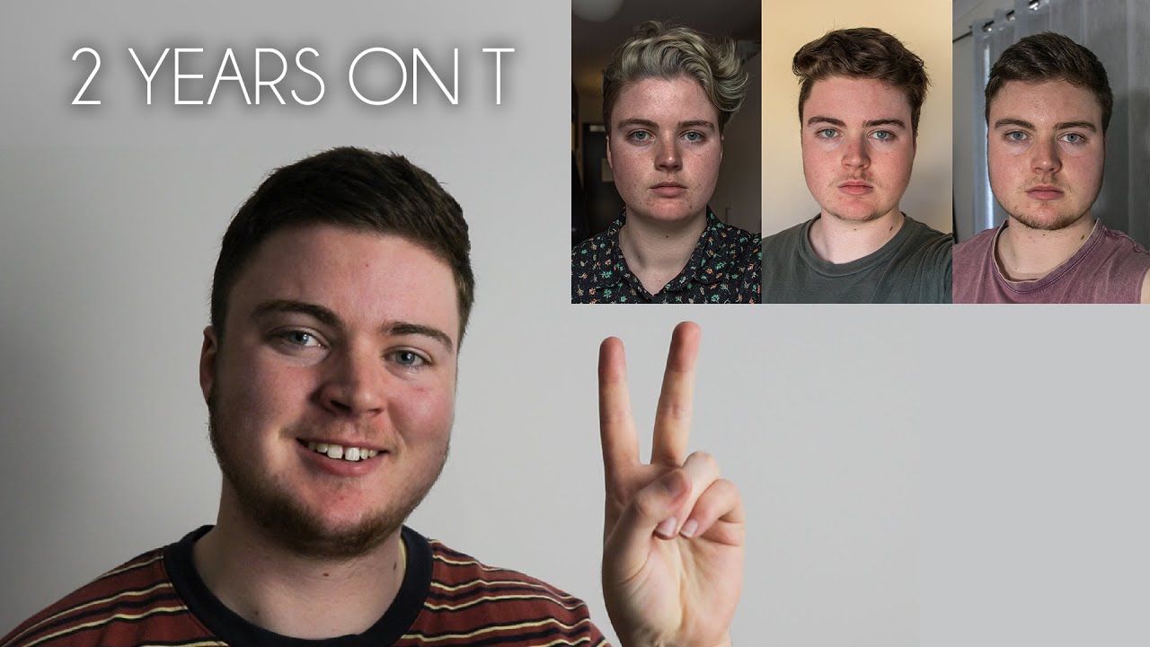 2 YEARS ON TESTOSTERONE COMPARISON // FTM Transgender transition ...