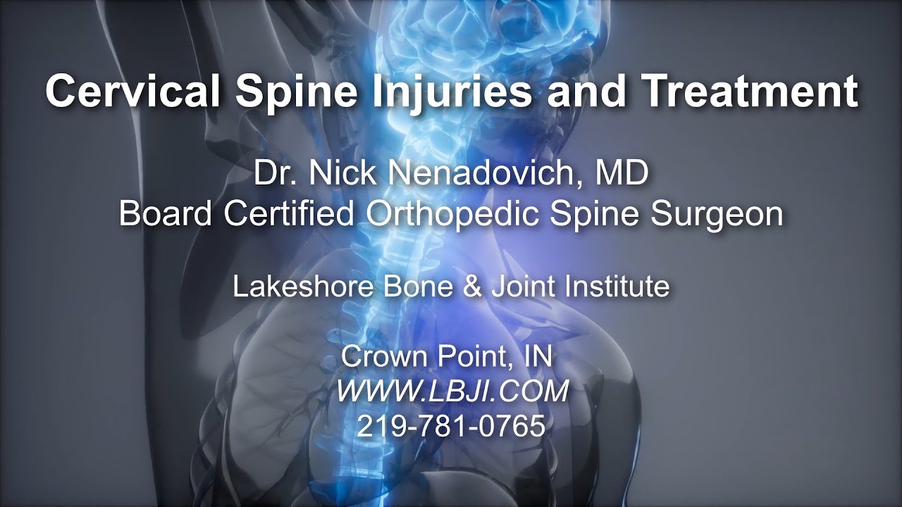 Cervical Spine Injuries and Treatments Dr. Nick Nenadovich, Board ...
