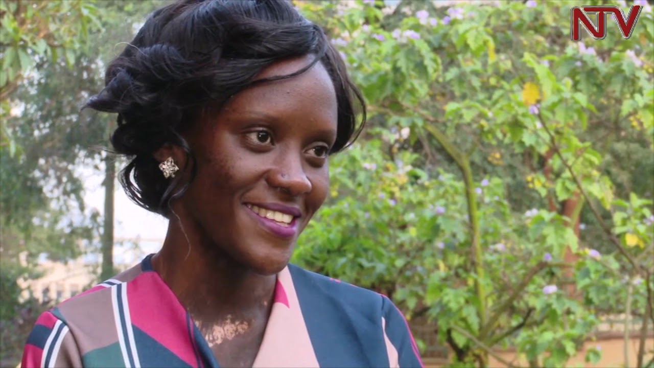 Aisha Nabukeera: Why Child Survivors can help reinforce the fight ...