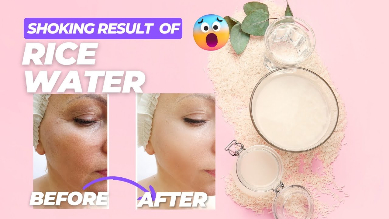Rice Water For Skin | Dr Narendra NIkumbh #ricewaterbenefits - YouTube