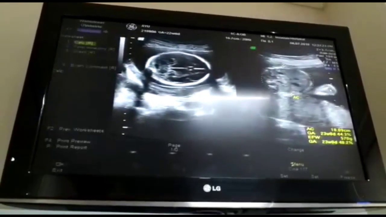 USG 22 WEEK (2D & 4D) - 11 JUNI 2020 - YouTube