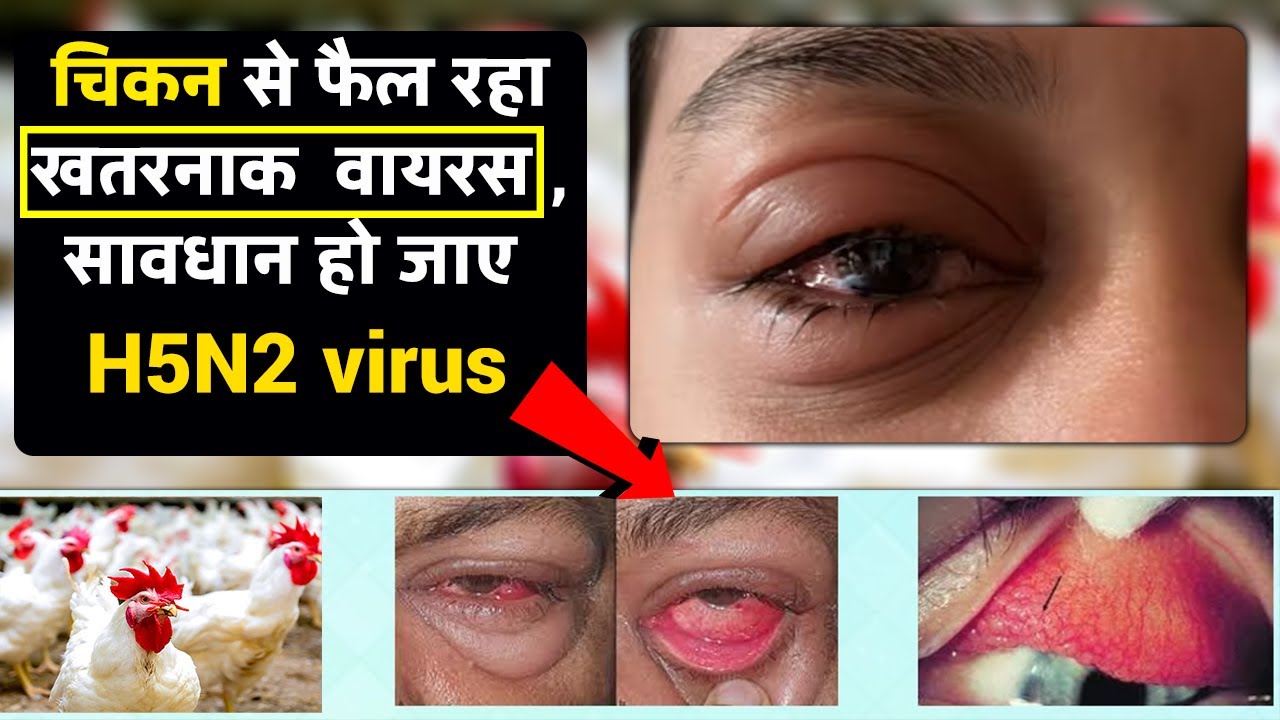 Breaking news : H5N2 से दुनिया में पहली मौत , चिकन से फैल रहा खतरनाक ...