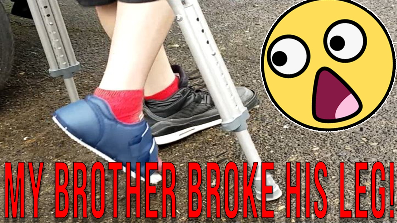 MY BROTHER BROKE HIS LEG! - YouTube