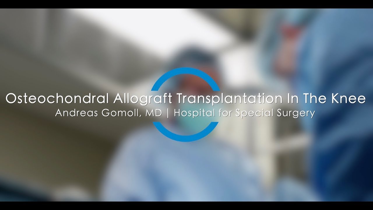 Osteochondral Allograft Transplantation In The Knee - YouTube